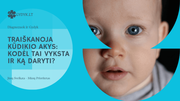 Traiškanoja kūdikio akys: kodėl tai vyksta ir ką daryti? - Gydyk.lt