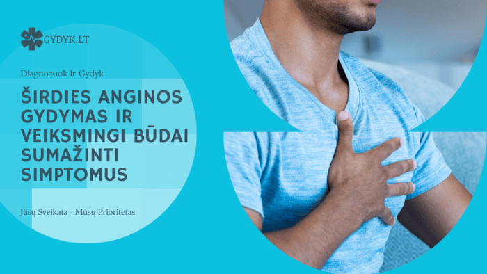 Širdies anginos gydymas ir veiksmingi būdai sumažinti simptomus - Gydyk.lt