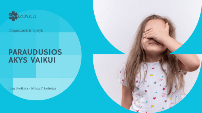 Paraudusios akys vaikui: kada tai infekcija, o kada alergija? - Gydyk.lt